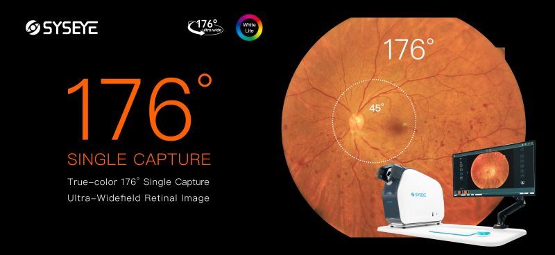 APAO 2026까지 2개월 남았습니다 | 스포트라이트: SYSEYE 176° True-Color 초광시야 안저 카메라 (부스 ...
